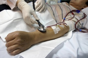 Photo.Medical.examining patient with dialysis shunt.SS1005645.color.HiRes