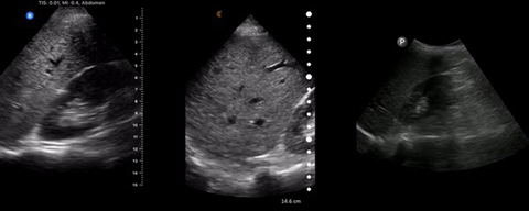 Portable ultrasound | This Changed My Practice (TCMP) by UBC CPD