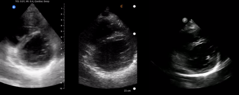 Portable ultrasound | This Changed My Practice (TCMP) by UBC CPD